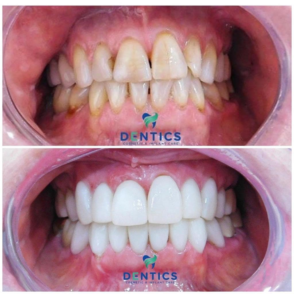 Dentics Cancun Dentistry – AllDentists